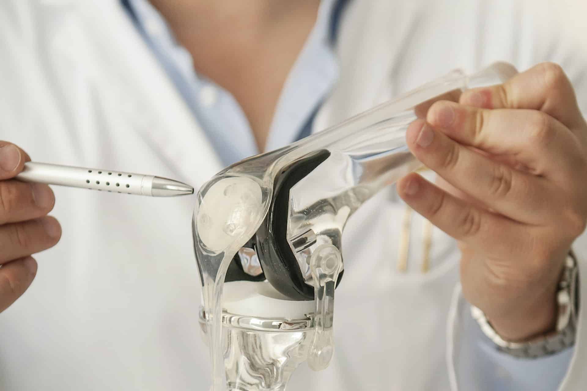 Comparing Partial and Total Knee Arthroplasty